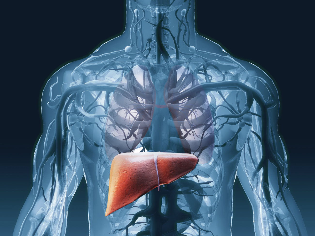 5 Sinais de Cirrose Hepática: Identificação e Cuidados